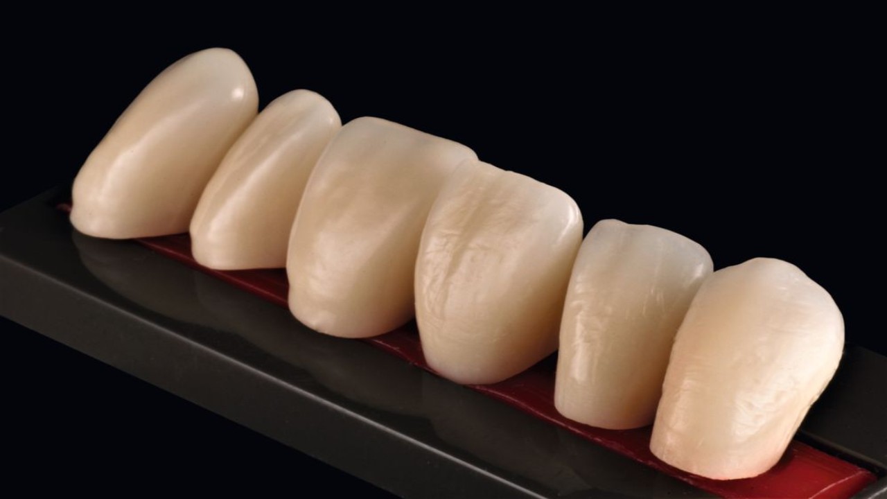 Choisir sa prothèse dentaire amovible : nos conseils