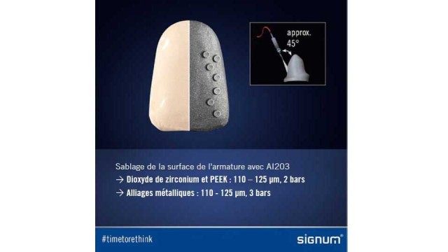 Signum® universal bond