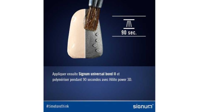 Signum® universal bond